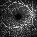 【OCT徹底比較】ニデックRS-330とZEISS CIRRUSの違いとは？価格・性能・画像精度を解説 | 0.5ミリ先