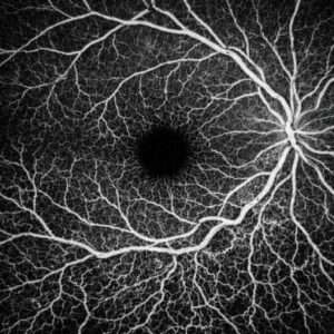 【OCT徹底比較】ニデックRS-330とZEISS CIRRUSの違いとは？価格・性能・画像精度を解説 | 0.5ミリ先