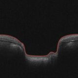 【OCT徹底比較】ニデックRS-330とZEISS CIRRUSの違いとは？価格・性能・画像精度を解説 | 0.5ミリ先