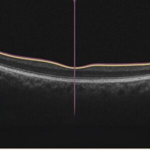 【OCT徹底比較】ニデックRS-330とZEISS CIRRUSの違いとは？価格・性能・画像精度を解説 | 0.5ミリ先